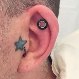 The Pedagogy Of Dermal Punching: Everything You Need To Know - Body Art ...