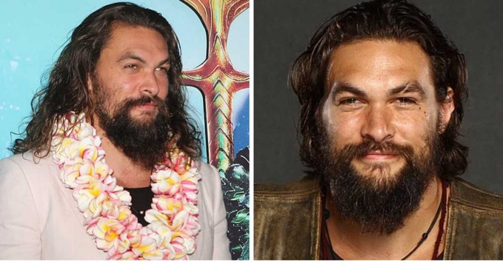 44 Celebrities With Scars - Body Art Guru