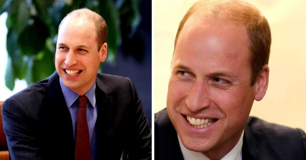 44 Celebrities With Scars - Body Art Guru