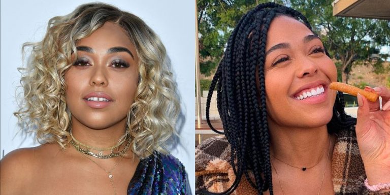 40+ Celebrities with Veneers - Body Art Guru