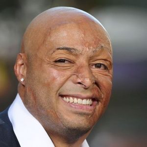 44 Celebrities With Scars - Body Art Guru