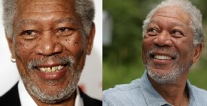 40+ Celebrities with Veneers - Body Art Guru