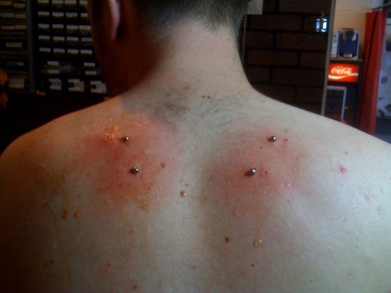 All That You Need To Know About Microdermal Implant - Body Art Guru