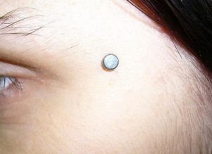 All That You Need To Know About Microdermal Implant - Body Art Guru