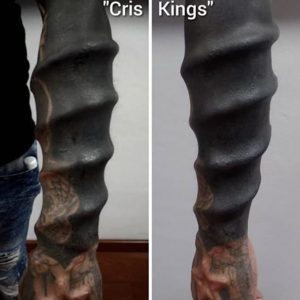 What is Subdermal Implant? - Body Art Guru