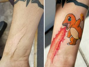 137 Cool Ideas for Hiding Scars With Tattoos - Body Art Guru