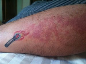 137 Cool Ideas for Hiding Scars With Tattoos - Body Art Guru