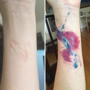 137 Cool Ideas for Hiding Scars With Tattoos - Body Art Guru