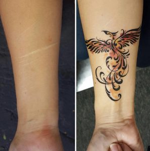 137 Cool Ideas for Hiding Scars With Tattoos - Body Art Guru